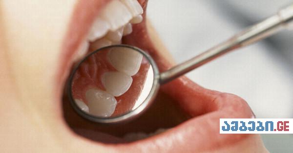 პირის ღრუს პათოლოგიები და ჰიგიენა - სტომატოლოგის რჩევები | Ambebi.GE